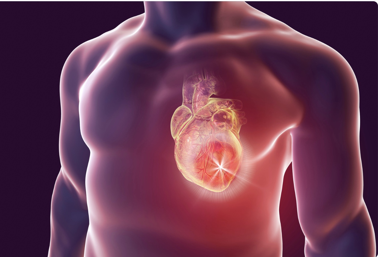 What Is Angina? - NowPatient